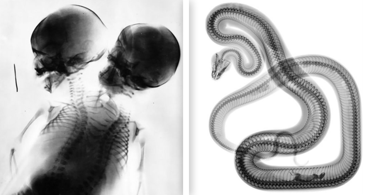 15 increíbles fotos de rayos X que debes mirar dos veces