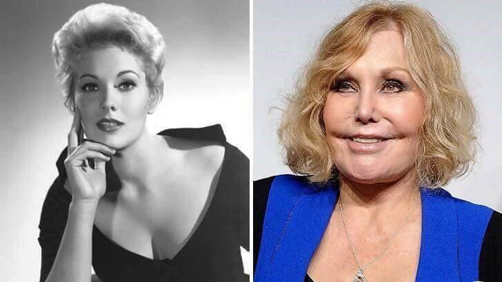 17 famosos que se destrozaron la cara gracias a una operación