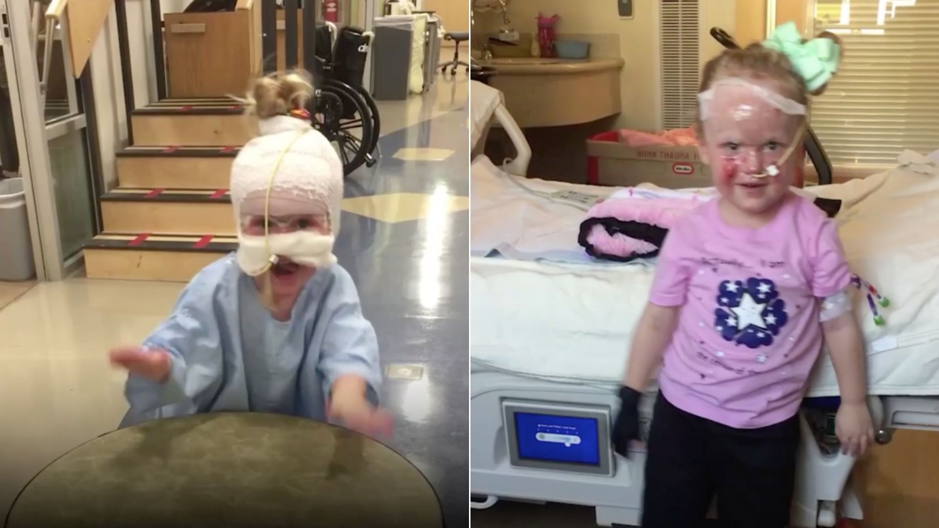 la chica de la cara quemada que enseña coraje